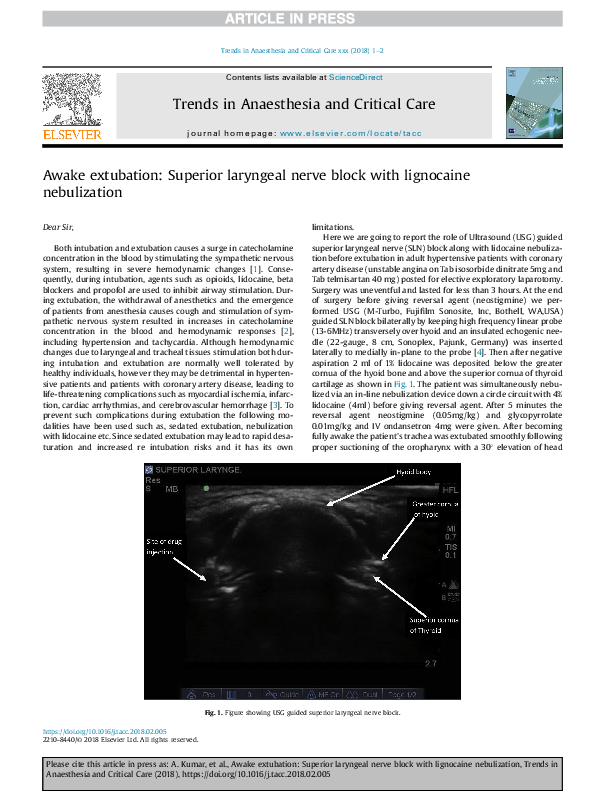 (PDF) Awake extubation: Superior laryngeal nerve block with lignocaine ...