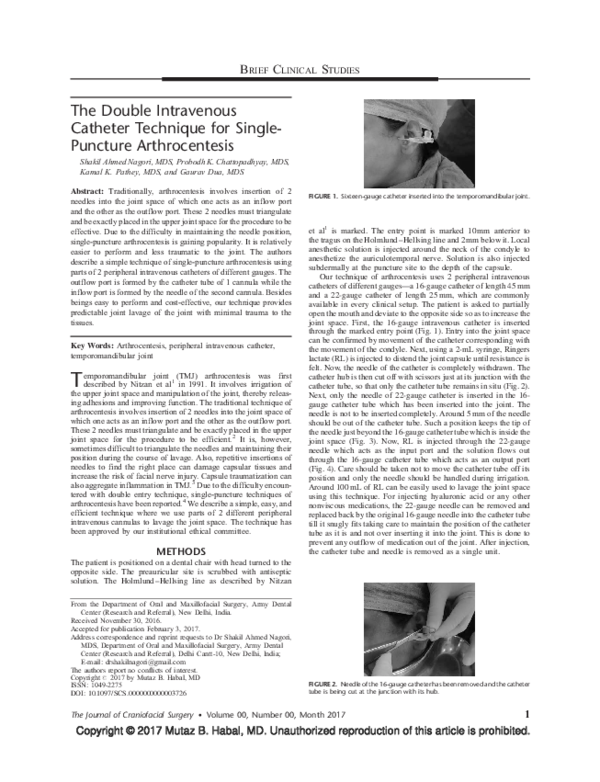 (PDF) The Double Intravenous Catheter Technique for Single-Puncture ...