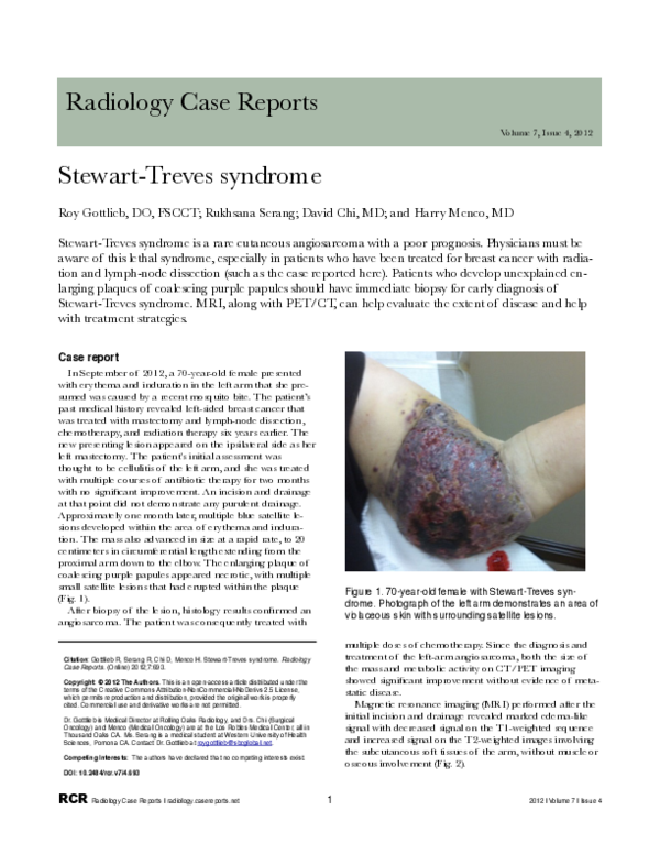 (PDF) Stewart-Treves syndrome