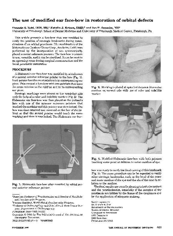 (PDF) The use of modified ear face-bow in restoration of orbital ...