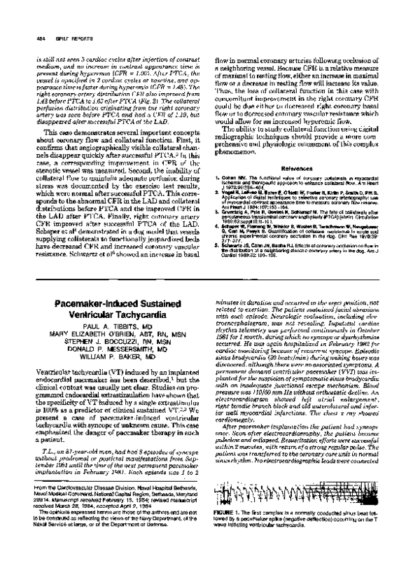 (PDF) Pacemaker-induced sustained ventricular tachycardia | paul ...