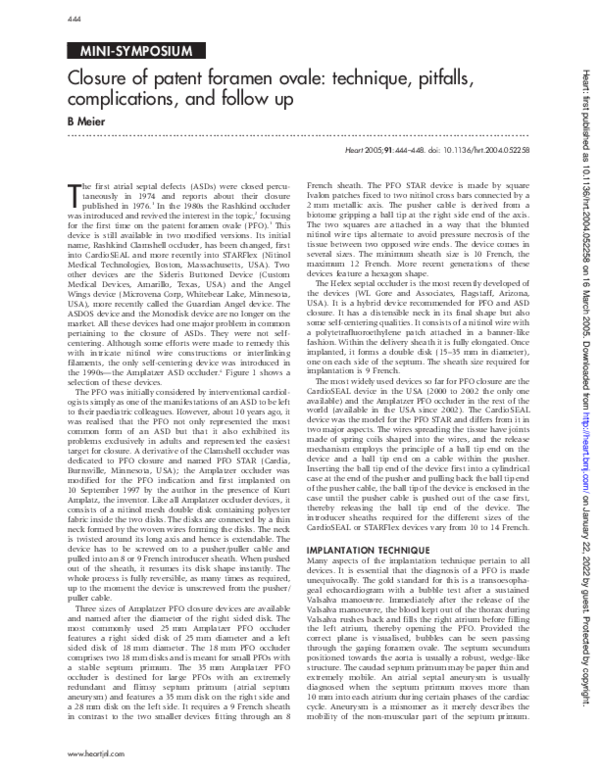 (PDF) Closure of patent foramen ovale: technique, pitfalls ...