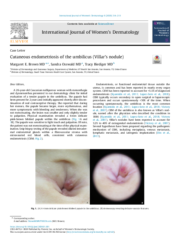 (PDF) Cutaneous endometriosis of the umbilicus (Villar’s nodule)