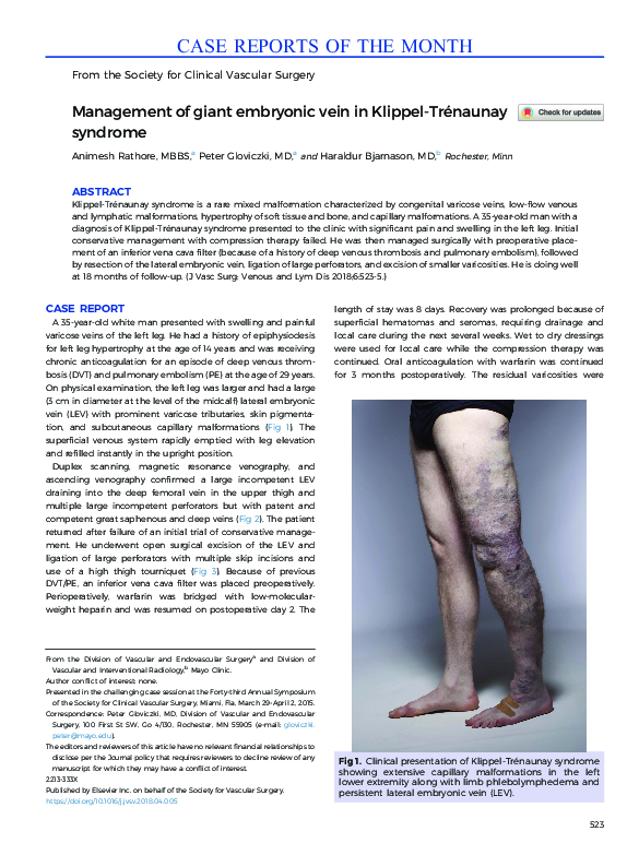 (PDF) Management of giant embryonic vein in Klippel-Trénaunay syndrome