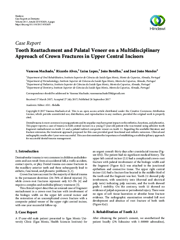 (PDF) Tooth Reattachment and Palatal Veneer on a Multidisciplinary ...