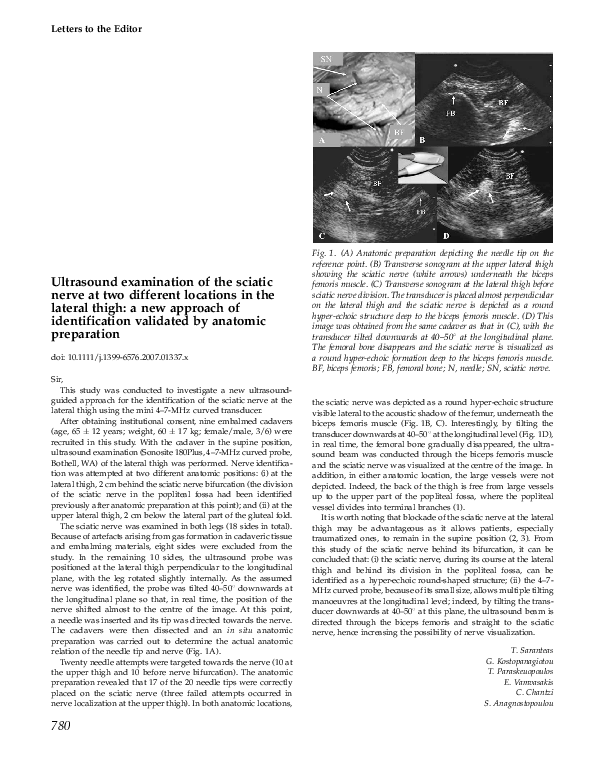 (PDF) Ultrasound examination of the sciatic nerve at two different ...