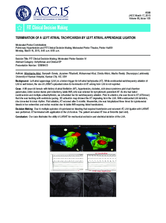 (PDF) Termination of a Left Atrial Tachycardia by Left Atrial Appendage ...