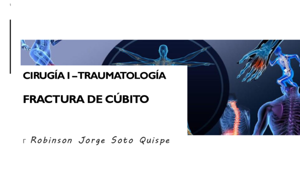 (PDF) FRACTURA DE CÚBITO