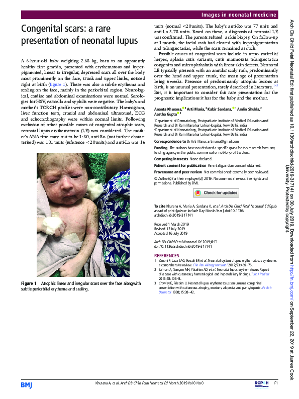 (PDF) Congenital scars: a rare presentation of neonatal lupus