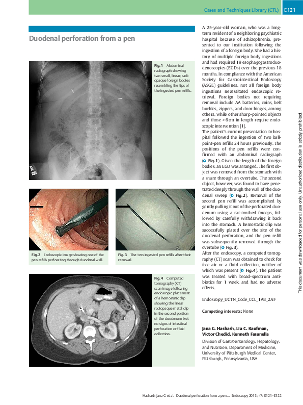 (PDF) Duodenal perforation from a pen