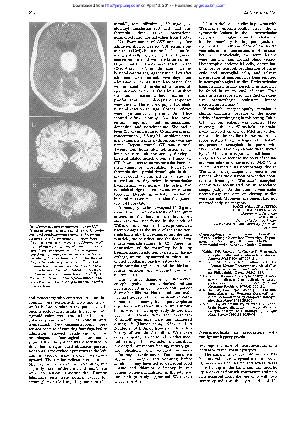 (PDF) Neuromyotonia in association with malignant hyperpyrexia