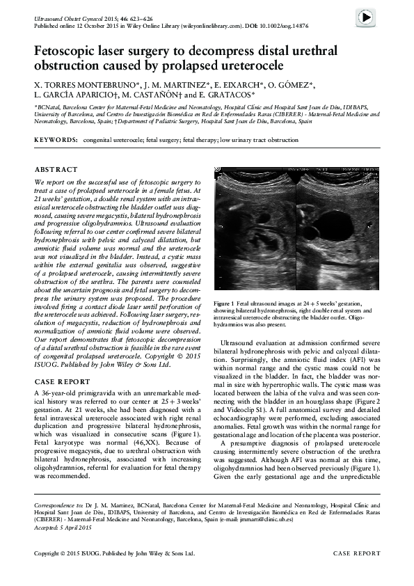 (PDF) Fetoscopic laser surgery to decompress distal urethral ...