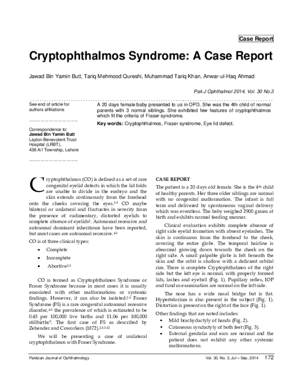 (PDF) Cryptophthalmos Syndrome: A Case Report