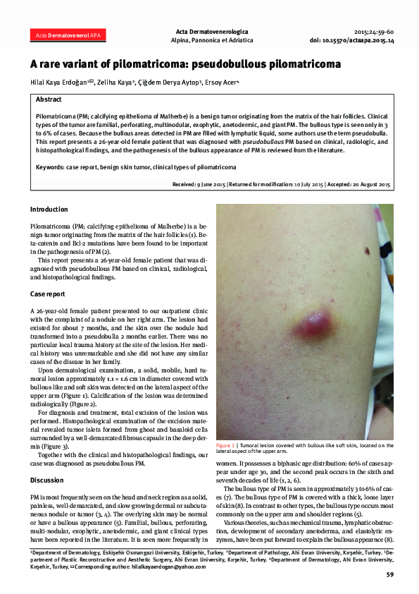 (PDF) A rare variant of pilomatricoma: pseudobullous pilomatricoma