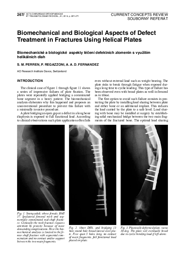(PDF) Biomechanical and Biological Aspects of Defect Treatment in ...
