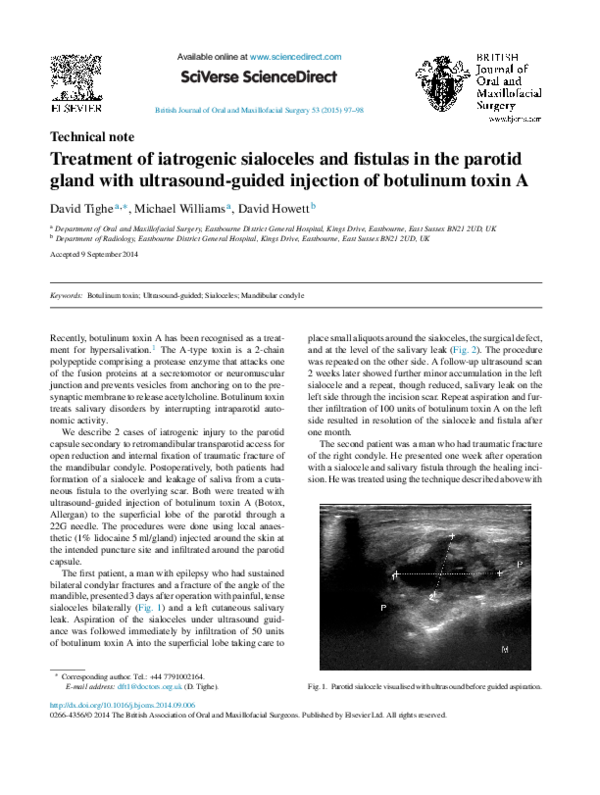 (PDF) Treatment of iatrogenic sialoceles and fistulas in the parotid ...
