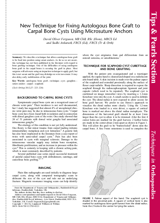 (PDF) New Technique for Fixing Autologous Bone Graft to Carpal Bone ...