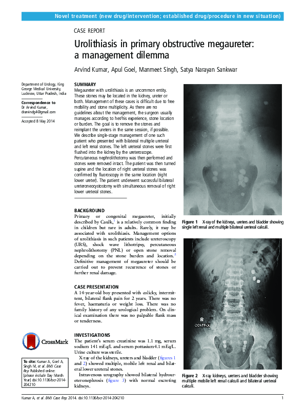 (PDF) Urolithiasis in primary obstructive megaureter: a management dilemma