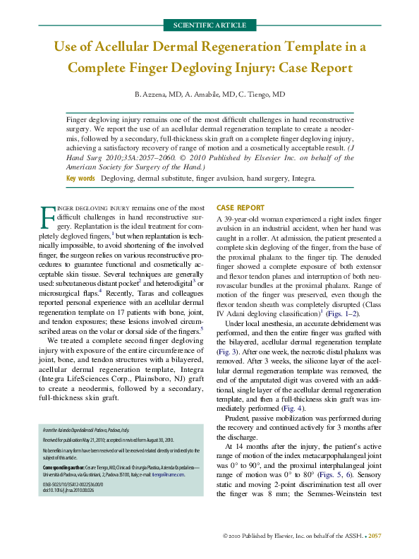 (PDF) Use of Acellular Dermal Regeneration Template in a Complete ...
