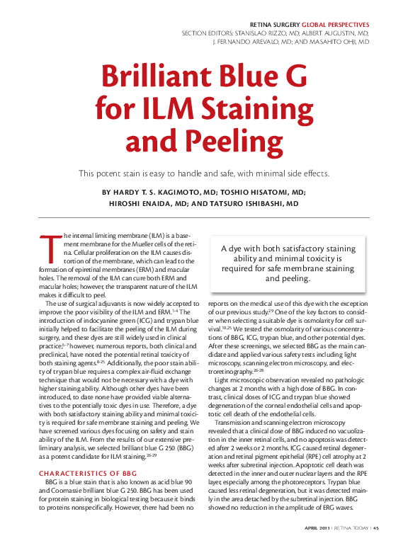 (PDF) Brilliant blue G for ILM staining and peeling: This potent stain ...