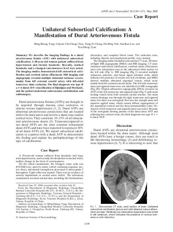 (PDF) Unilateral subcortical calcification: a manifestation of dural ...