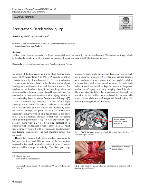 (PDF) Acceleration–Deceleration Injury