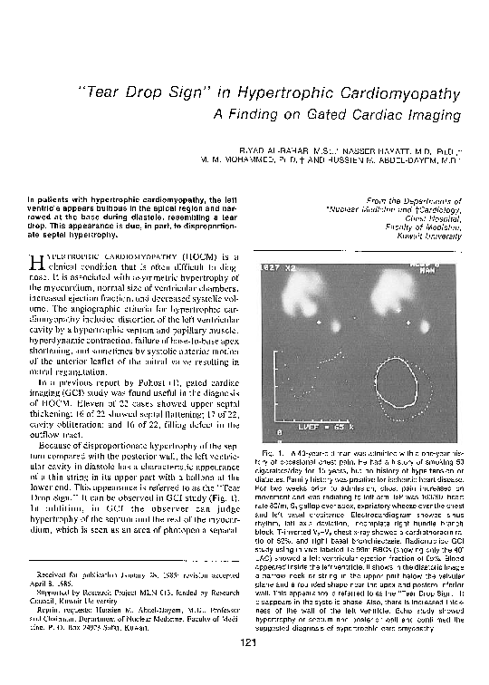 (PDF) ???Tear Drop Sign??? in Hypertrophic Cardiomyopathy