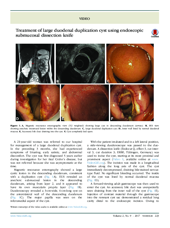 (PDF) Treatment of large duodenal duplication cyst using endoscopic ...
