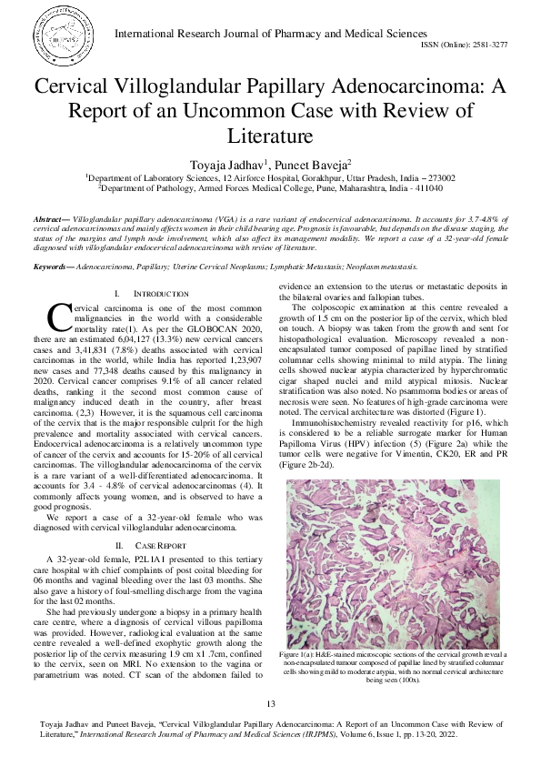 (PDF) Cervical Villoglandular Papillary Adenocarcinoma: A Report of an ...