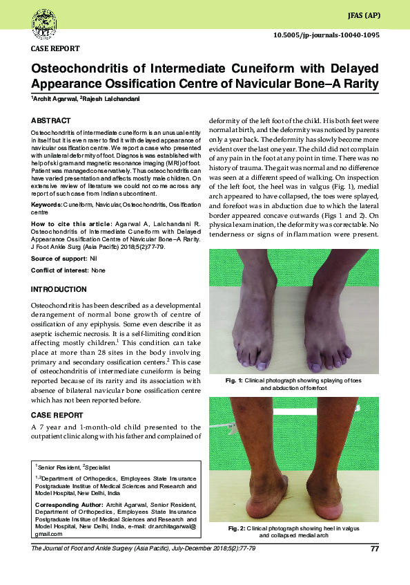 (PDF) Osteochondritis of Intermediate Cuneiform with Delayed Appearance ...