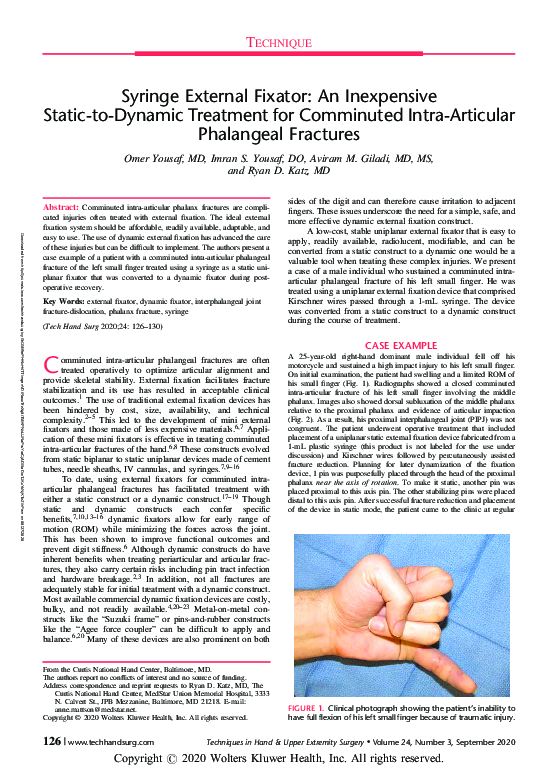 (PDF) Syringe External Fixator: An Inexpensive Static-to-Dynamic Treatment for Comminuted Intra ...