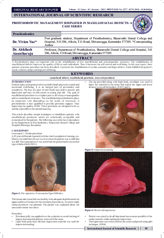 (PDF) ORIGINAL RESEARCH PAPER PROSTHODONTIC MANAGEMENT SIMPLIFIED IN ...