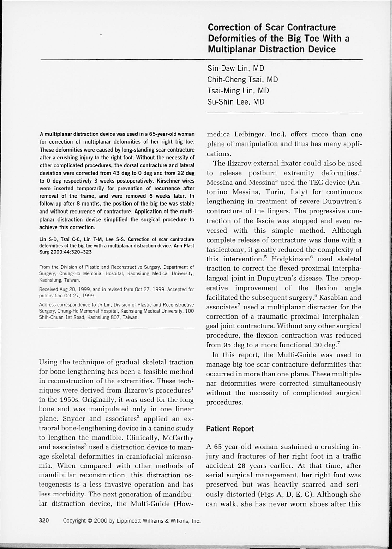 (PDF) Correction of Scar Contracture Deformities of the Big Toe With a ...
