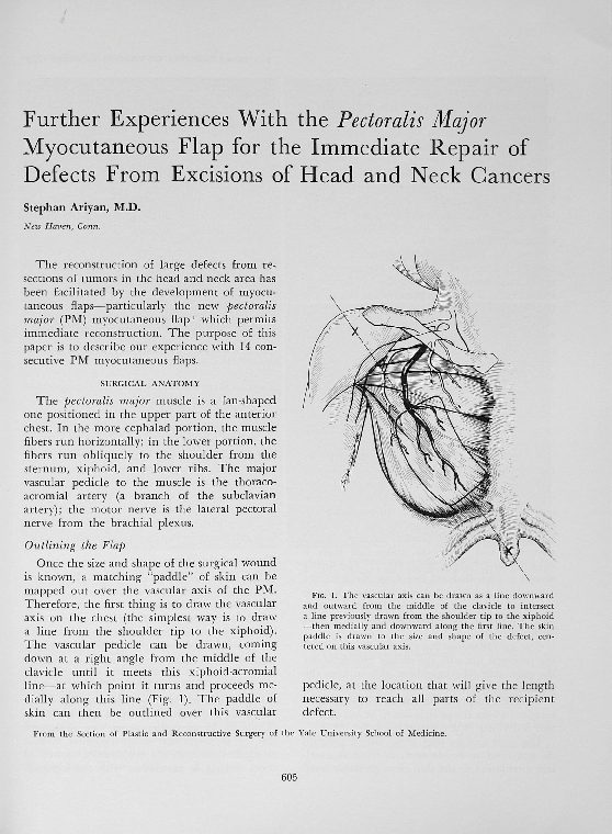 (PDF) Further Experiences With the Pectoralis Major Myocutaneous Flap ...