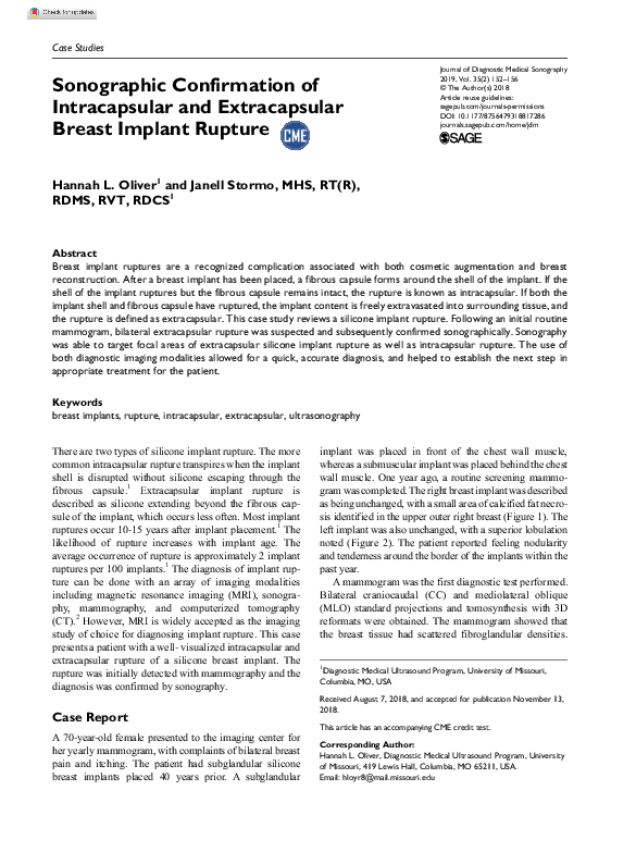 (PDF) Sonographic Confirmation of Intracapsular and Extracapsular ...