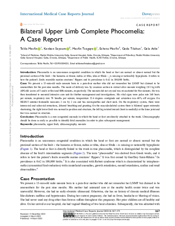 (PDF) Bilateral Upper Limb Complete Phocomelia: A Case Report | Telila ...