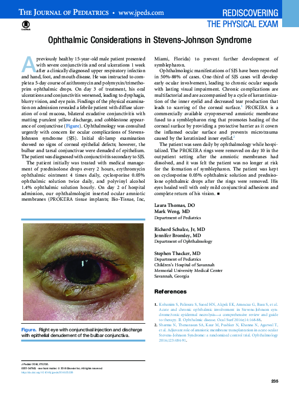 (PDF) Ophthalmic Considerations in Stevens-Johnson Syndrome