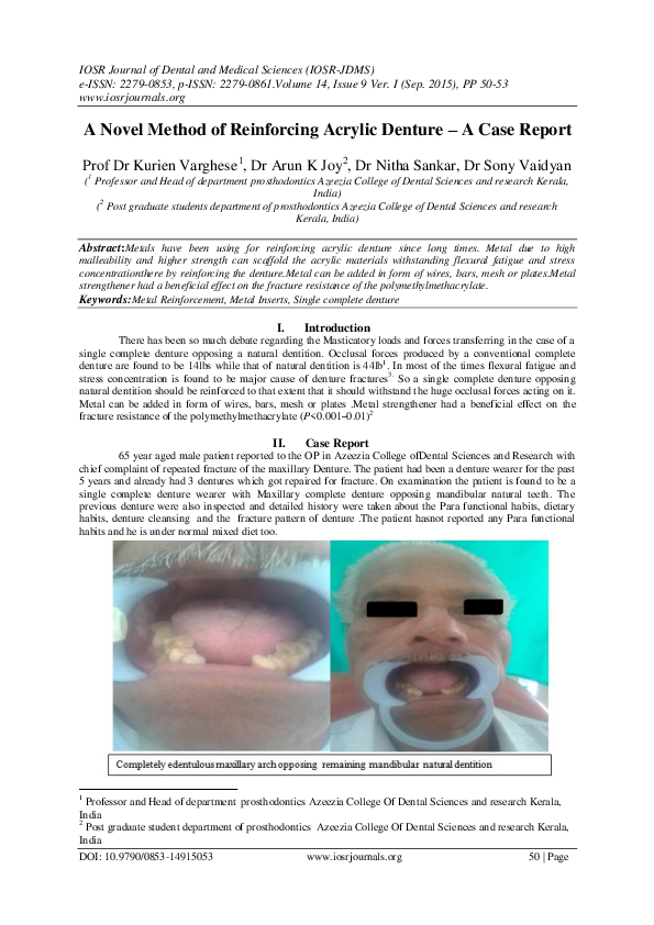 (PDF) A Novel Method of Reinforcing Acrylic Denture - A Case Report