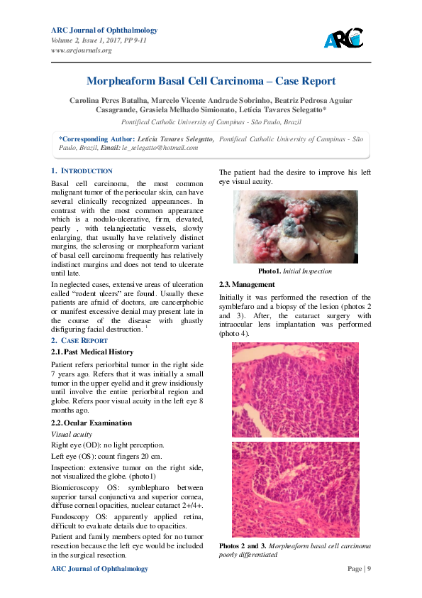 (PDF) Morpheaform Basal Cell Carcinoma – Case Report