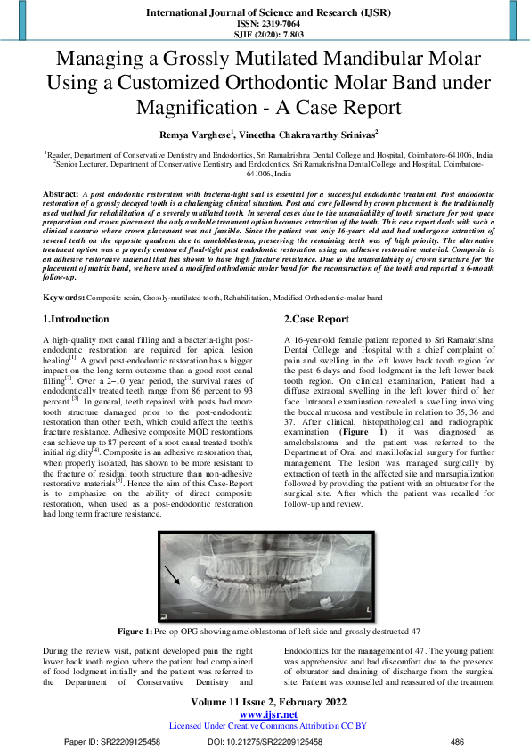 (PDF) Managing a Grossly Mutilated Mandibular Molar Using a Customized ...