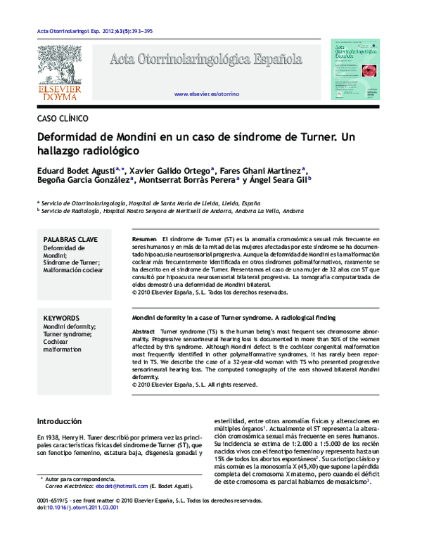 (PDF) Deformidad de Mondini en un caso de síndrome de Turner. Un ...