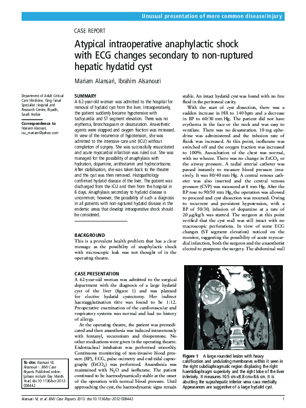 (PDF) Atypical intraoperative anaphylactic shock with ECG changes ...