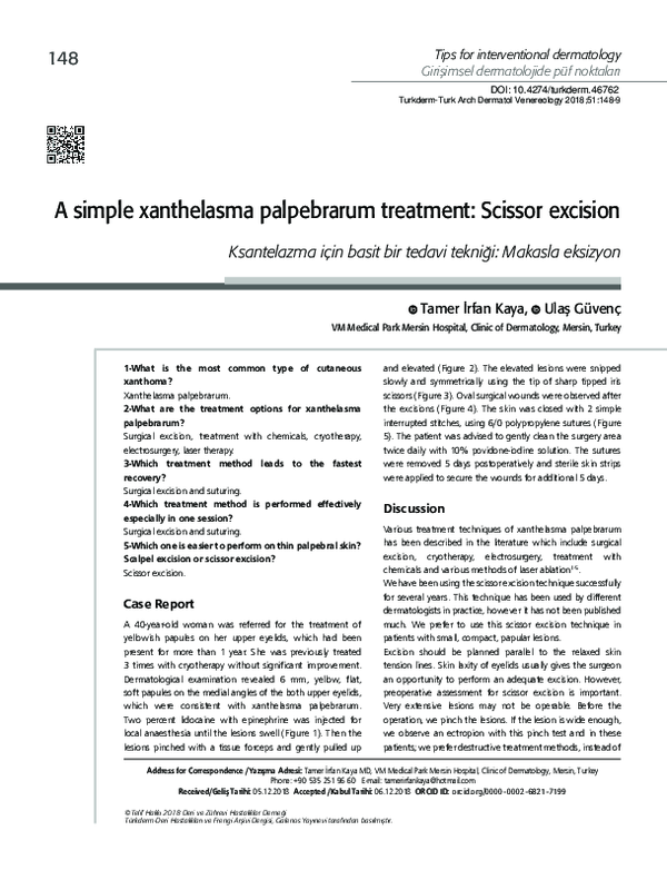 (PDF) A simple xanthelasma palpebrarum treatment: Scissor excision
