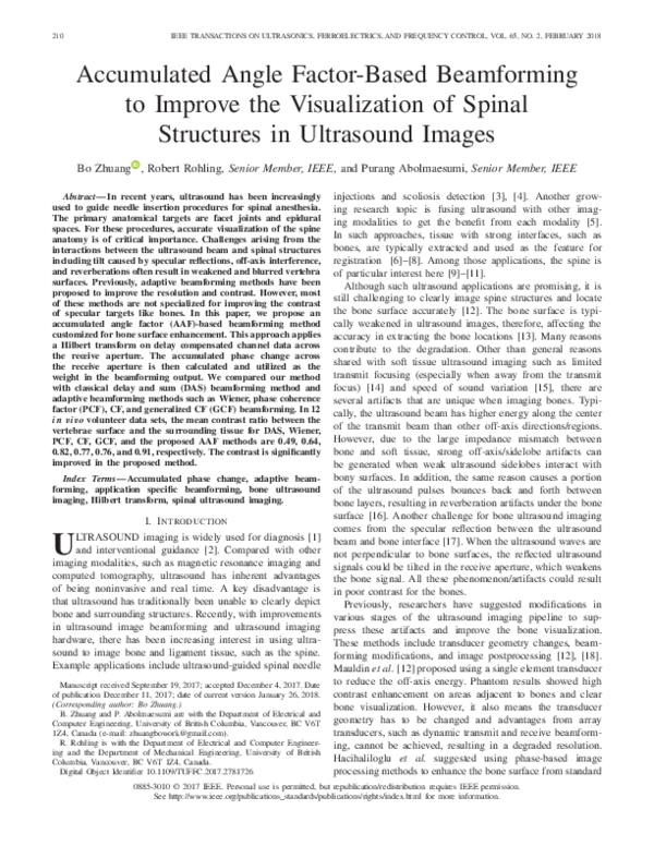 (PDF) Accumulated Angle Factor-Based Beamforming to Improve the ...