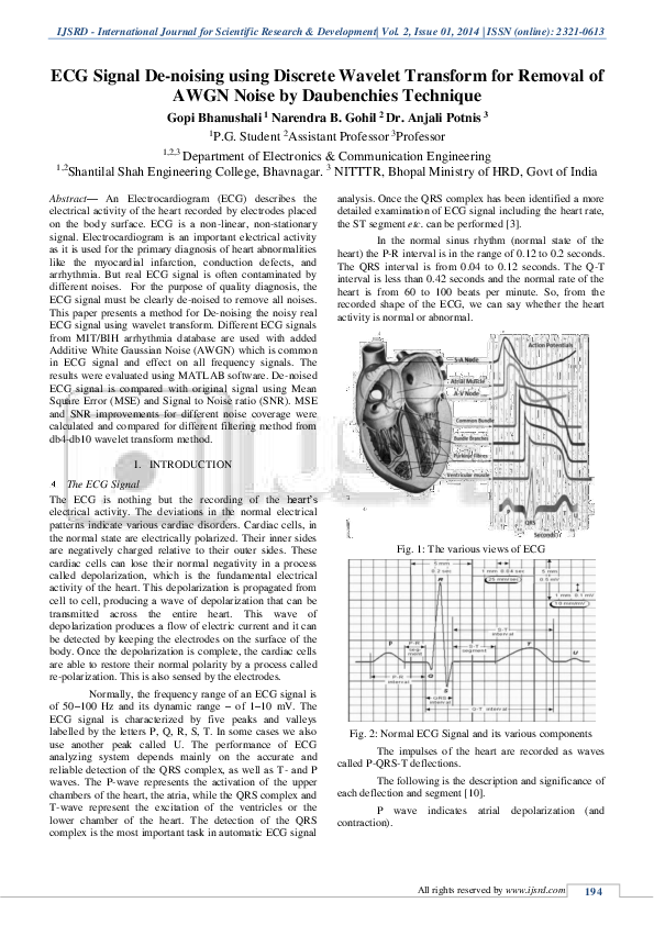 Pdf Ecg Signal Denoising Using Discrete Wavelet Transform For Removal Of Awgn Noise By