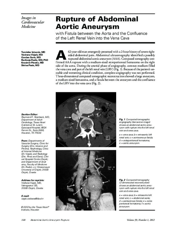 (PDF) Rupture of abdominal aortic aneurysm: with fistula between the ...