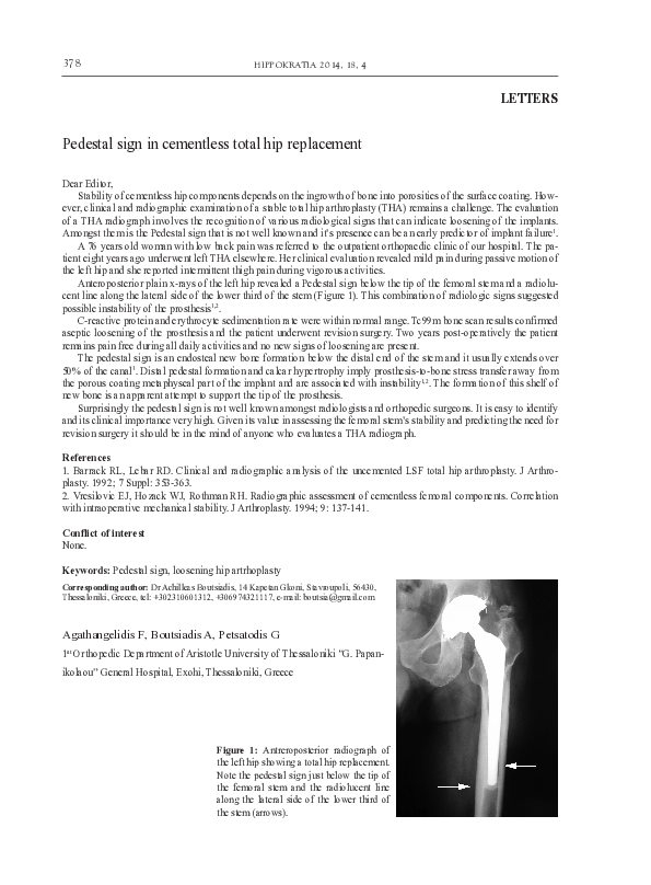 (PDF) Pedestal sign in cementless total hip replacement