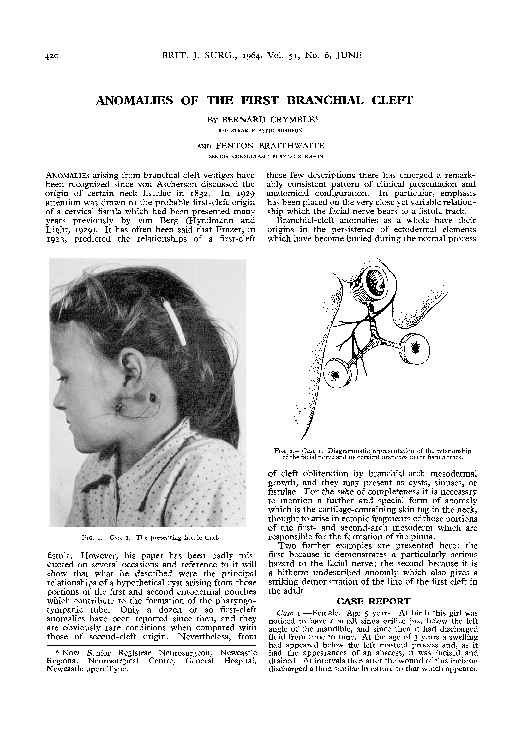 (PDF) Anomalies of the First Branchial Cleft