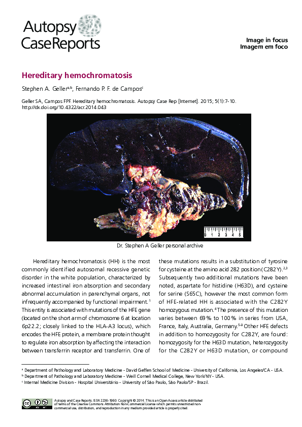 (PDF) Hereditary hemochromatosis
