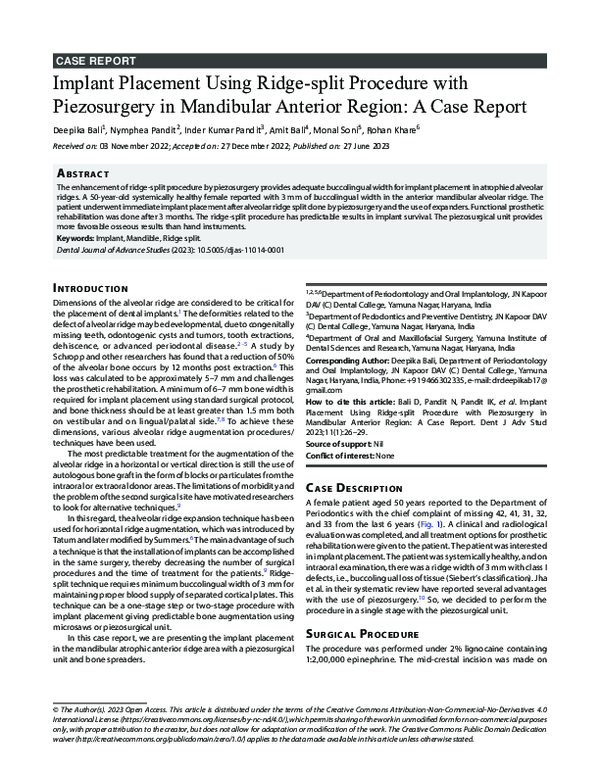 (PDF) Implant Placement Using Ridge-split Procedure with Piezosurgery ...